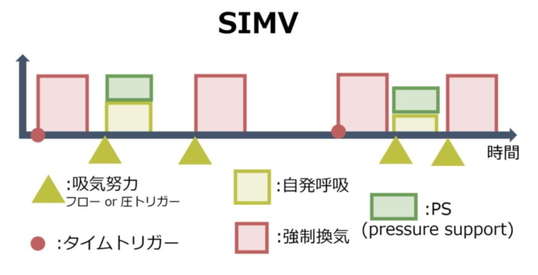SIMVモードについて - Ad.nurse